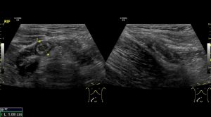 Basics techniques needed to evaluate the Appendix! – Integrated ...