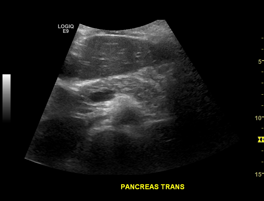 ‘The Pancreas” – Integrated Ultrasound Education