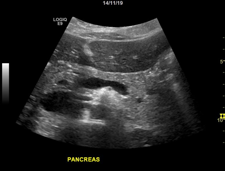 ‘The Pancreas” – Integrated Ultrasound Education